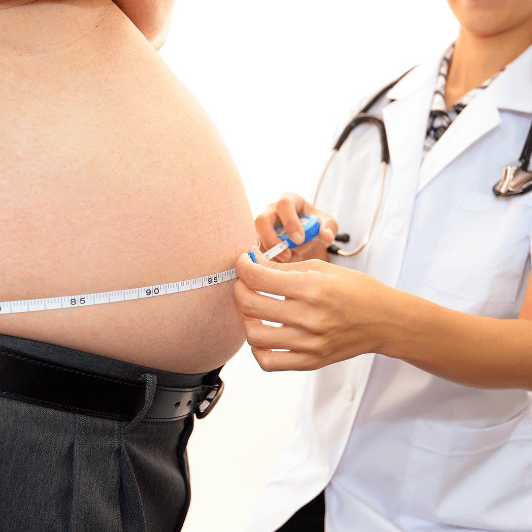 Obesity Surgery - Lokman Hekim Health Group